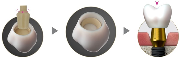 네오 ‘YK Link System’ 서울·대구 세미나 성료